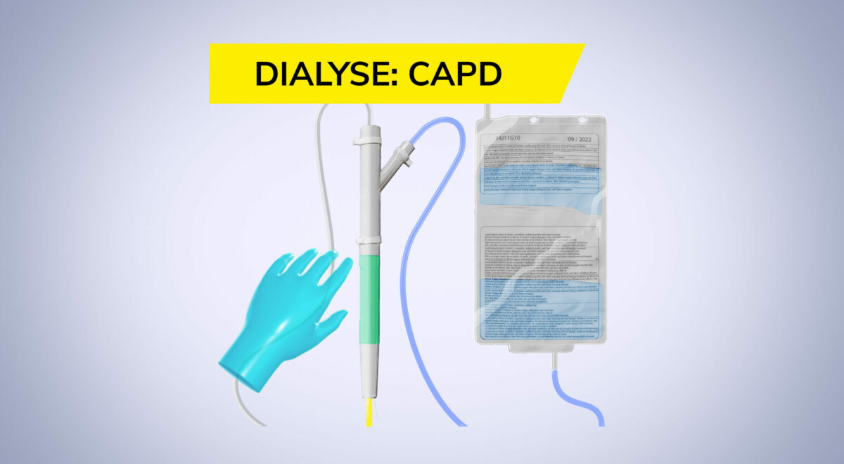 Dialyse: CAPD - Weltenmacher